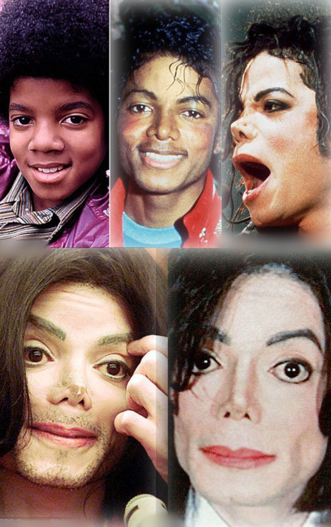 The impressive 25 years of “plastic surgery” of pop king Michael ...