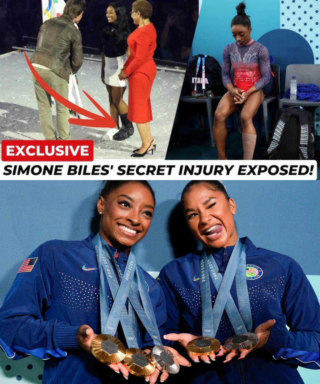 Why Simone Biles was wearing a boot at the Closing Ceremony - News