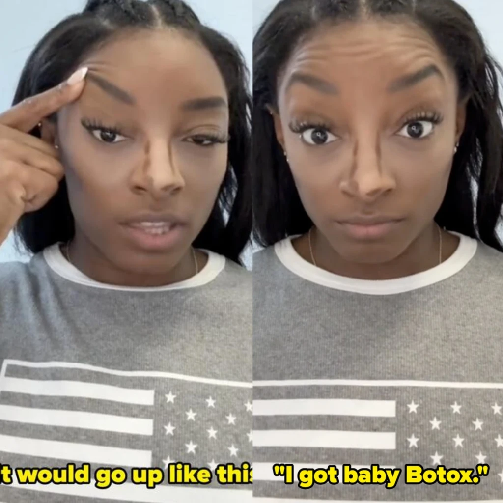 Simone Biles reveals her bad experience with Botox. This is why she ...
