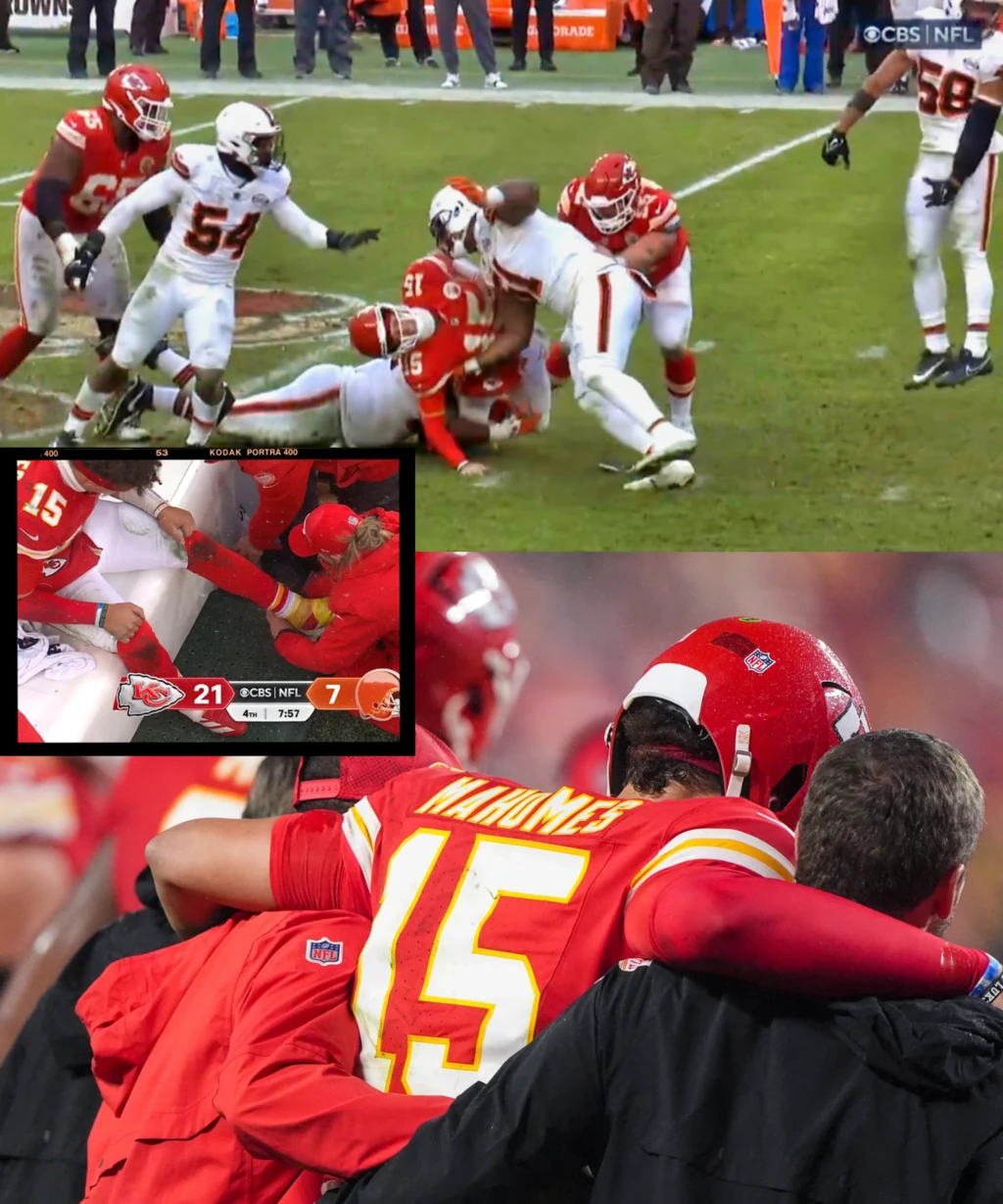 Scary Scene: Patrick Mahomes Suffers Leg Injury, Limping Off During ...