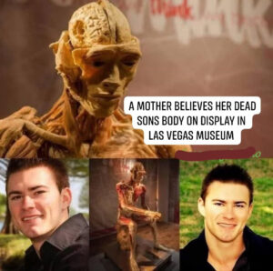 Mother Shocked to Discover Missing Son’s Body on Display in Museum - News