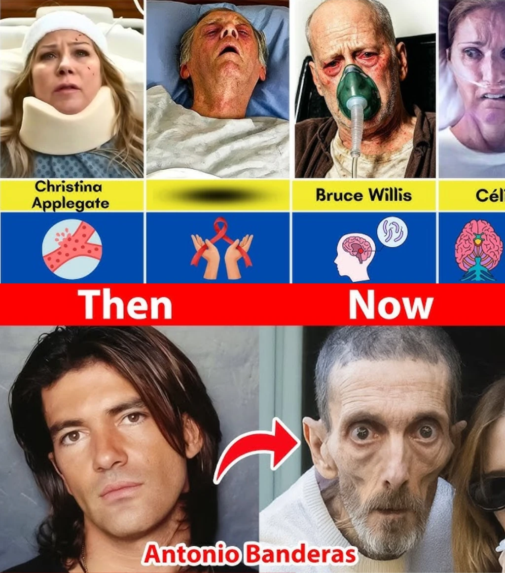 50 Famous Actors Who Are Dying and You Didn't Know – You’ll Be Shocked ...